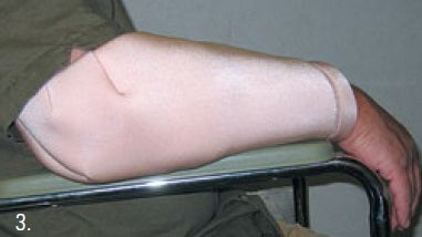 DermaSaver Arm-Bow – CosmacHealthcare